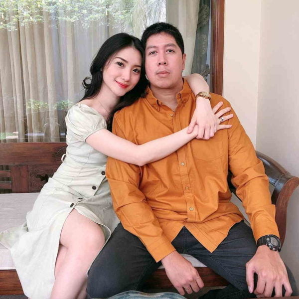 Sudah Menikah, 10 Potret Rachel Octavia yang Masih Mempesona Bak Remaja