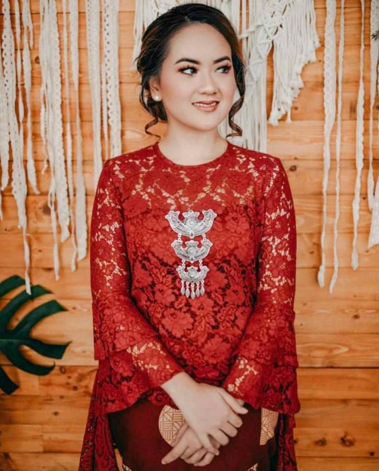 10 Potret Alifah Ratu Saelynda, Beauty Vlogger Panutan Para Acne Fighter